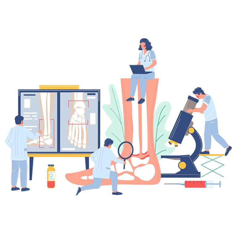 How Broken Bone X-Ray Helps Diagnose Fractures